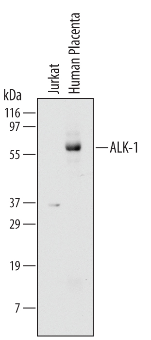 Human ALK‑1 Antibody (MAB370) | Bio-Techne