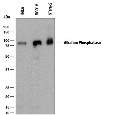Human Alkaline Phosphatase/ALPL Antibody (MAB29092) | Bio-Techne