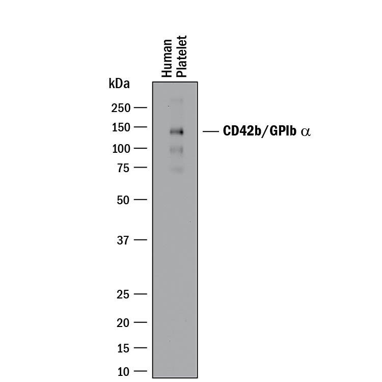 Human CD42b/GPIb alpha Antibody (AF4067) | Bio-Techne