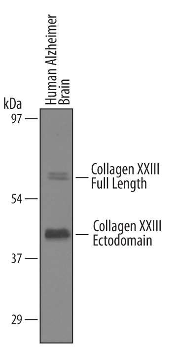 Human Collagen XXIII alpha1 Antibody (AF4165) | Bio-Techne