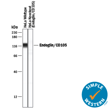 Human Endoglin/CD105 Antibody (AF1097) | Bio-Techne