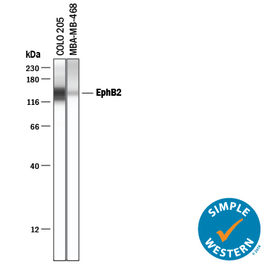 Human/Mouse EphB2 Antibody (AF467) | Bio-Techne