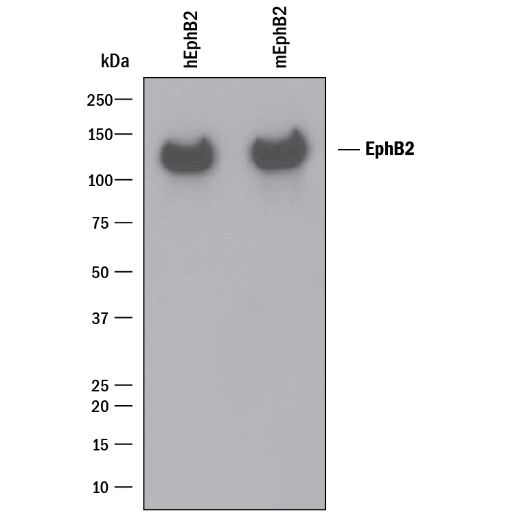 Human/Mouse EphB2 Antibody (AF467) | Bio-Techne
