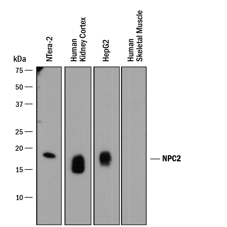 Human Niemann-Pick Type C2/NPC2 Antibody (AF8644) | Bio-Techne