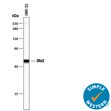 Human Otx2 Antibody (AF1979) | Bio-Techne