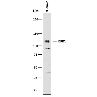 Human ROR1 Antibody (AF2000) | Bio-Techne