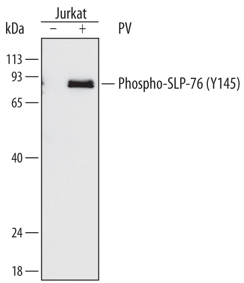 Human Phospho-SLP‑76/LCP2 (Y145) Antibody (MAB7474) | Bio-Techne