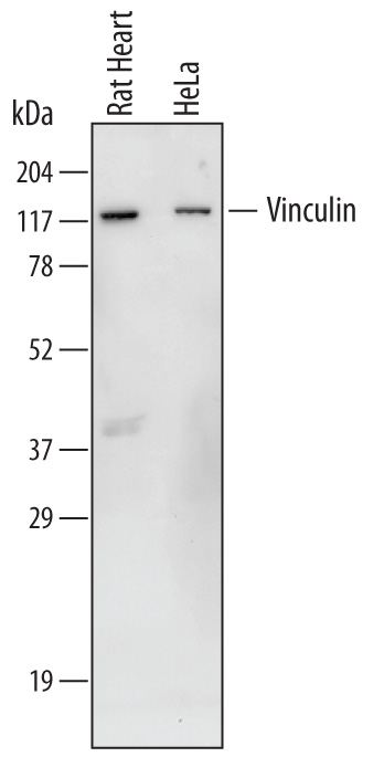 Human/Rat Vinculin Antibody (AF6896) | Bio-Techne
