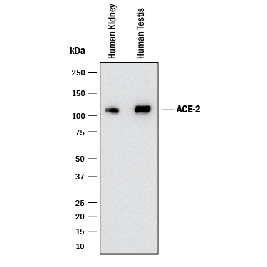 Human ACE‑2 Antibody (MAB10823) | Bio-Techne