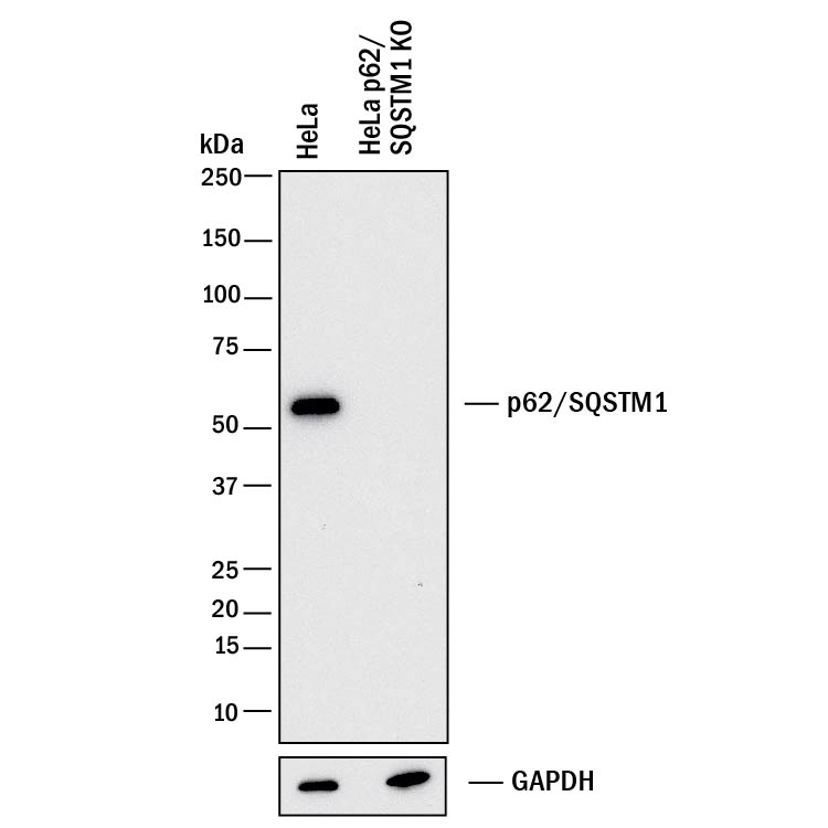 Human p62/SQSTM1 Antibody (MAB80281) | Bio-Techne