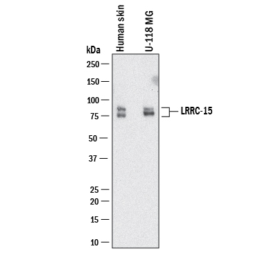 Human LRRC15 Antibody (MAB11324) | Bio-Techne