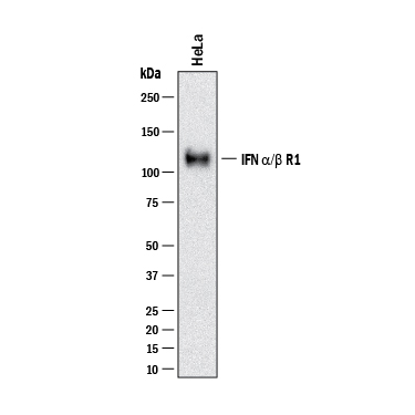 Human IFN-alpha / beta R1 Antibody (MAB2451) | Bio-Techne