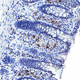 Human RANK/TNFRSF11A Antibody (MAB6832) | Bio-Techne